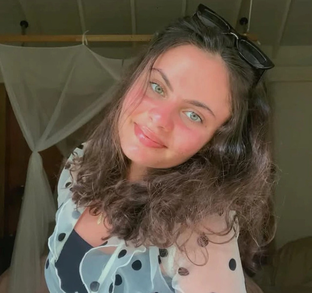 Why This Woman Quit Washing Her Face—and The Shocking Skin ...